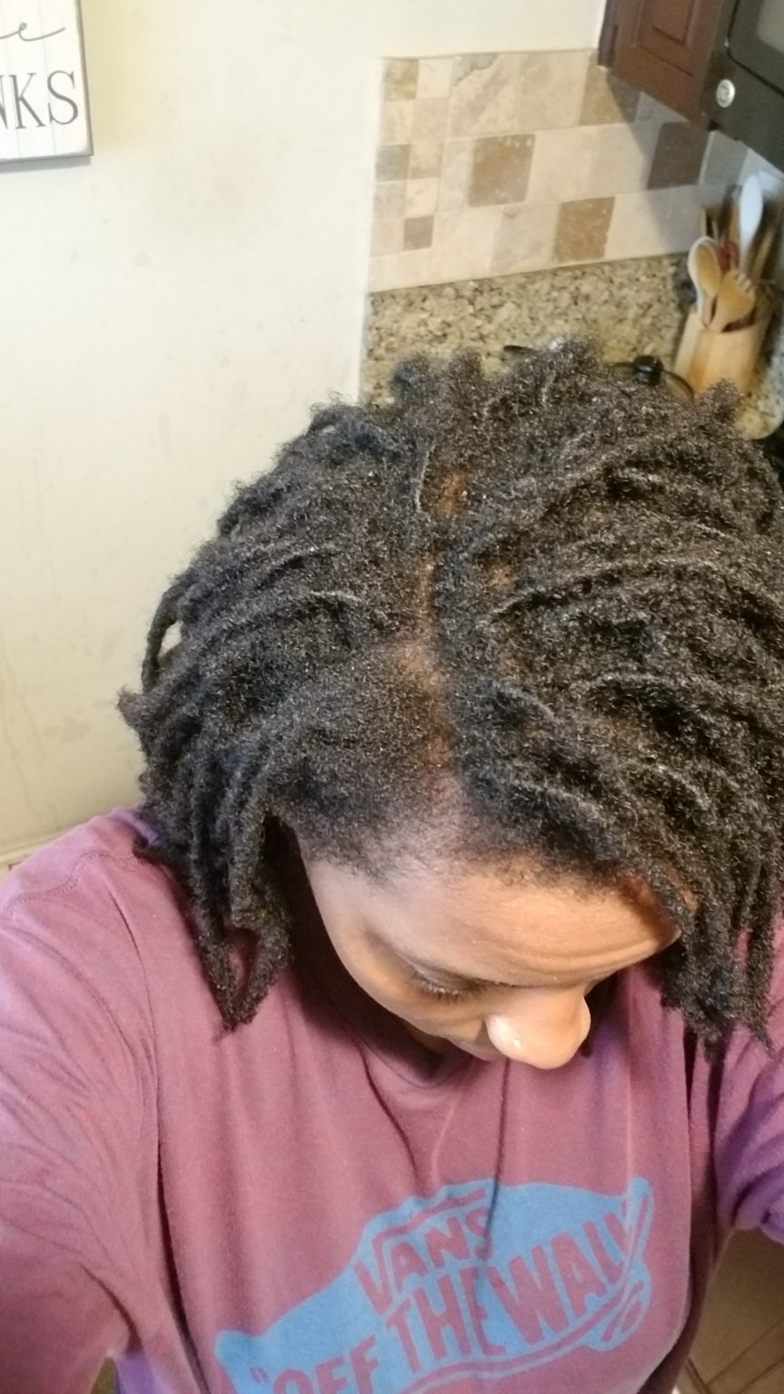 5 Ways To Save Your Thinning Locs – OMAFUFU